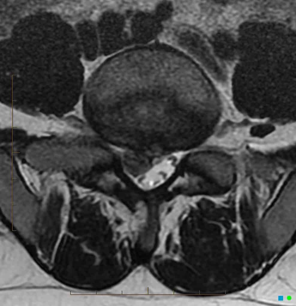 MRT-Untersuchung: Ein aktueller Guide für Patienten.