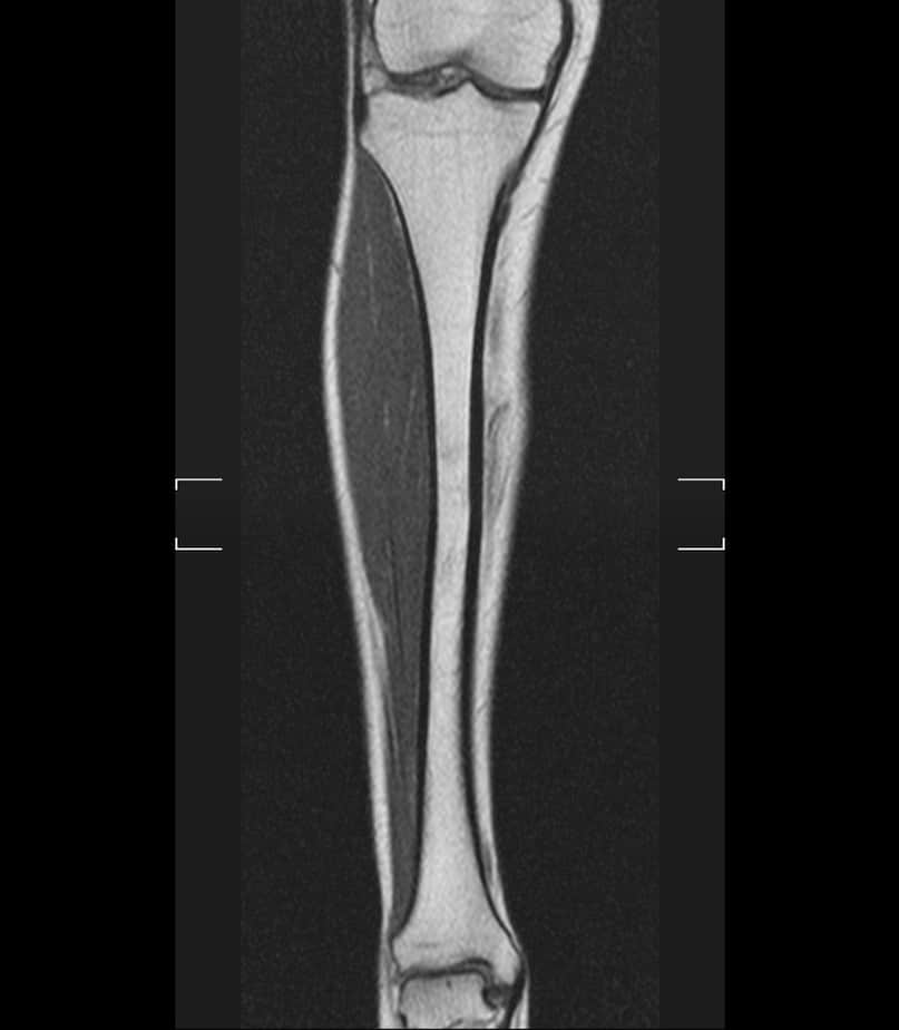 Ganzkörper MRT Checkup - Vorsorge-Prävention