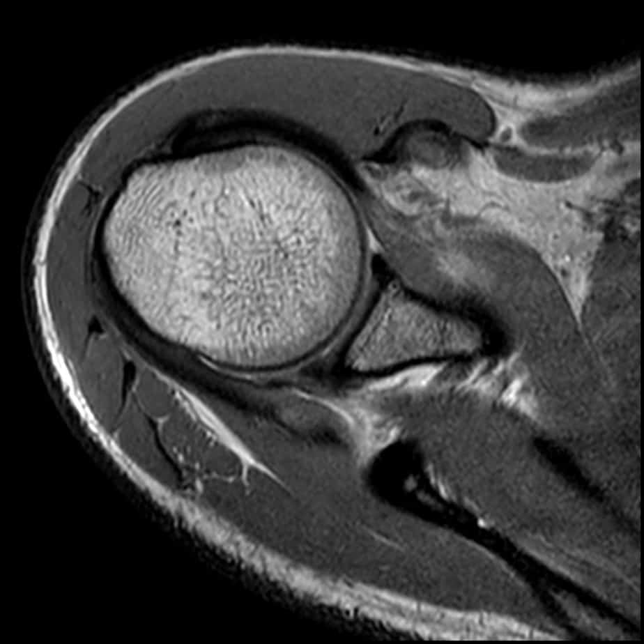 MRT-Untersuchung: Ein aktueller Guide für Patienten.